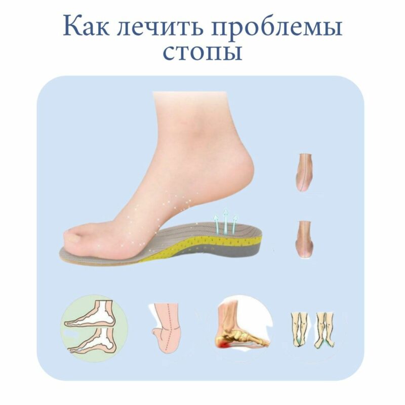 Здоровье нередко начинается или заканчивается со стоп! - Соклиника